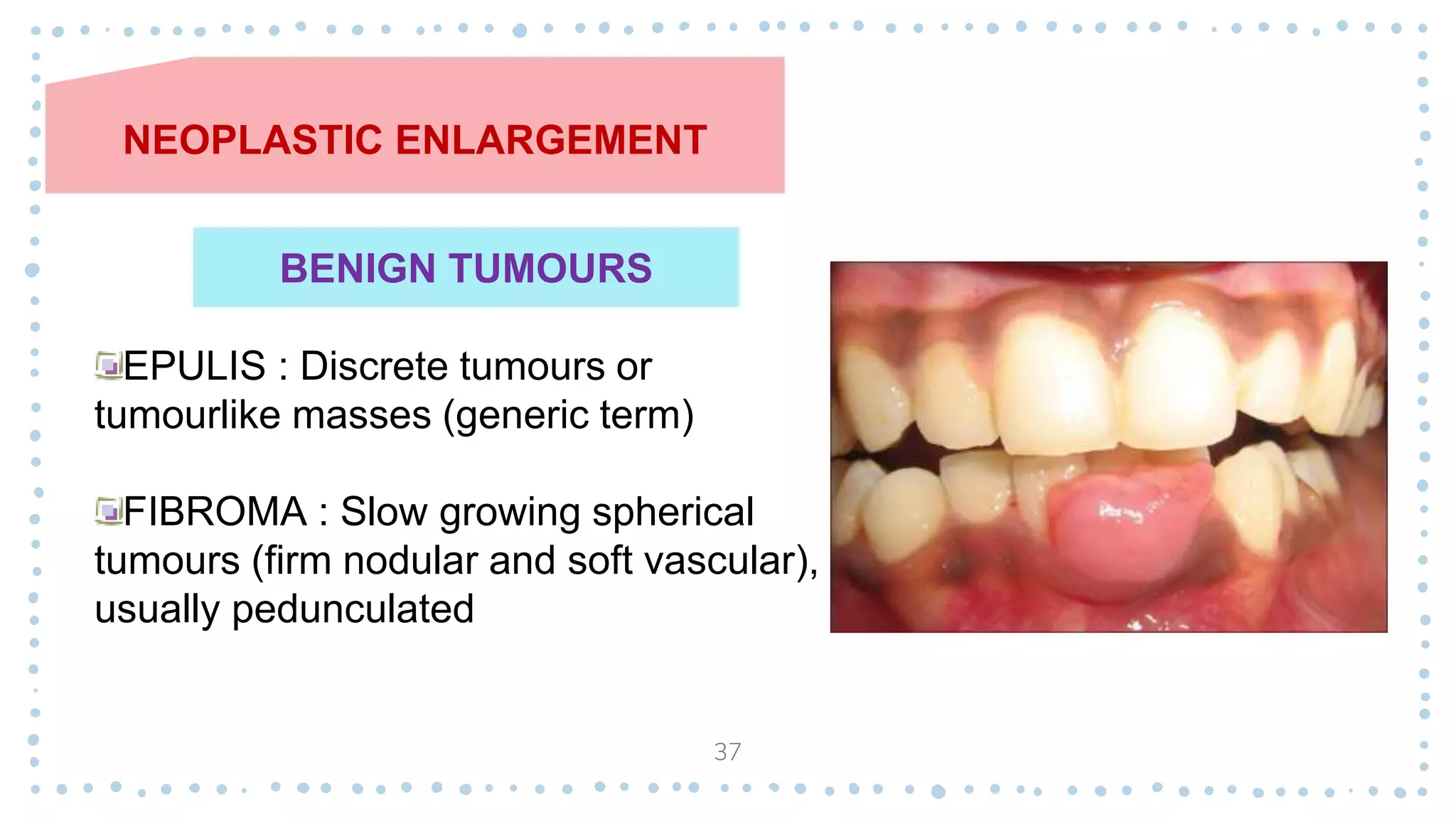 Gingival pathology | PPTX