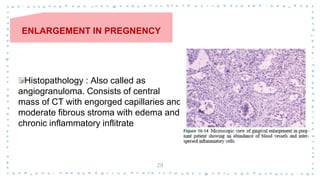 Gingival pathology | PPTX