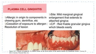 Gingival pathology | PPTX