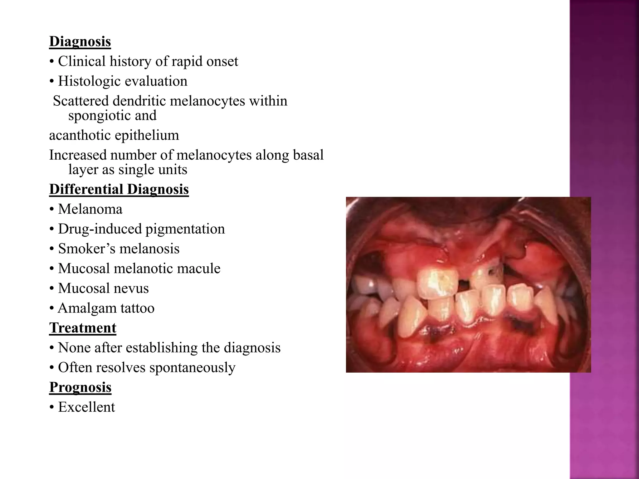 Gingival pigmentation.... | PPTX