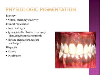 Gingival pigmentation.... | PPTX