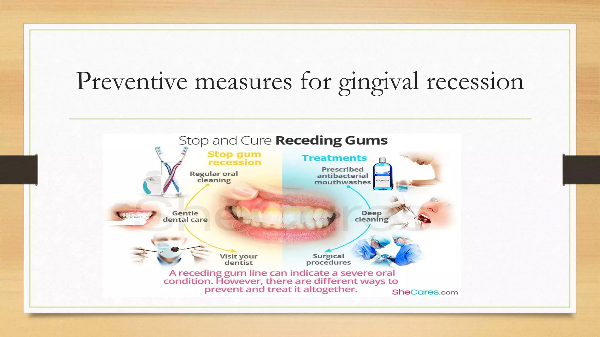 Gingival Recession, Gums Recession, | PPTX