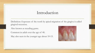 Gingival Recession, Gums Recession, | PPTX