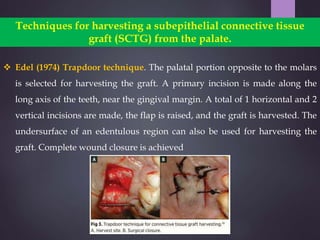 Gingival recession aries | PPTX