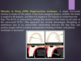 Gingival recession aries | PPTX