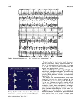 Gingival recession—can orthodontics be a cure? evidence from a case ...
