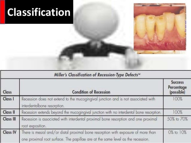 Gingival recession
