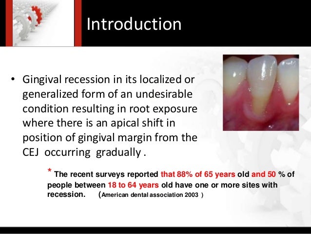Gingival recession