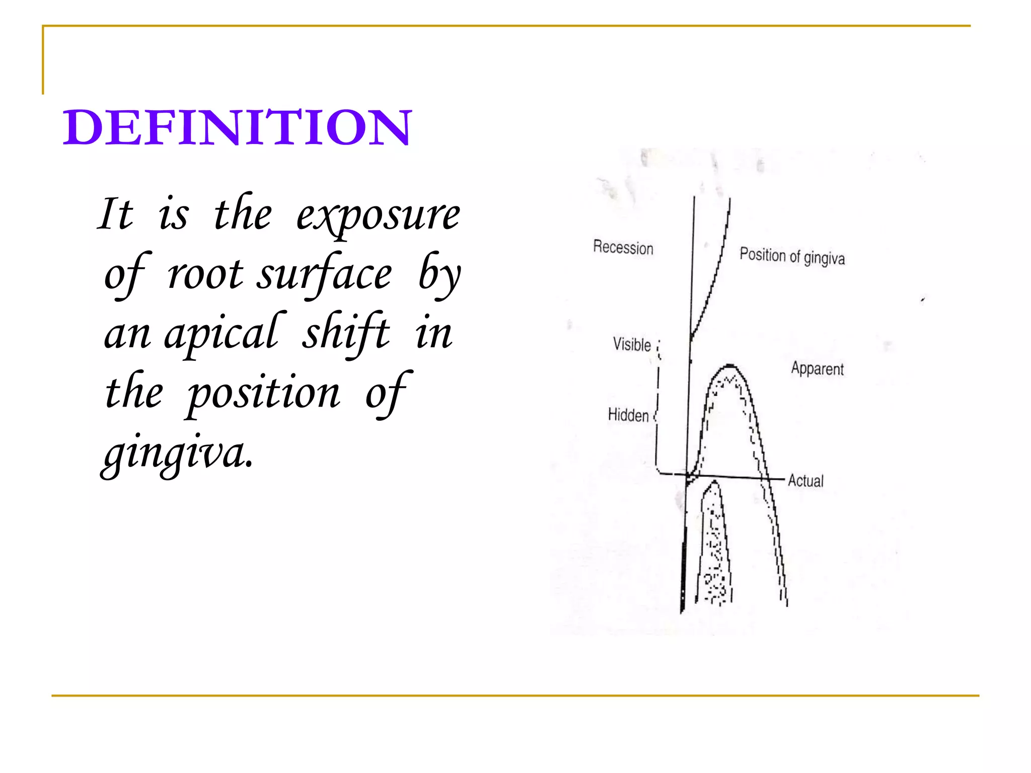 Gingival recession | PPT