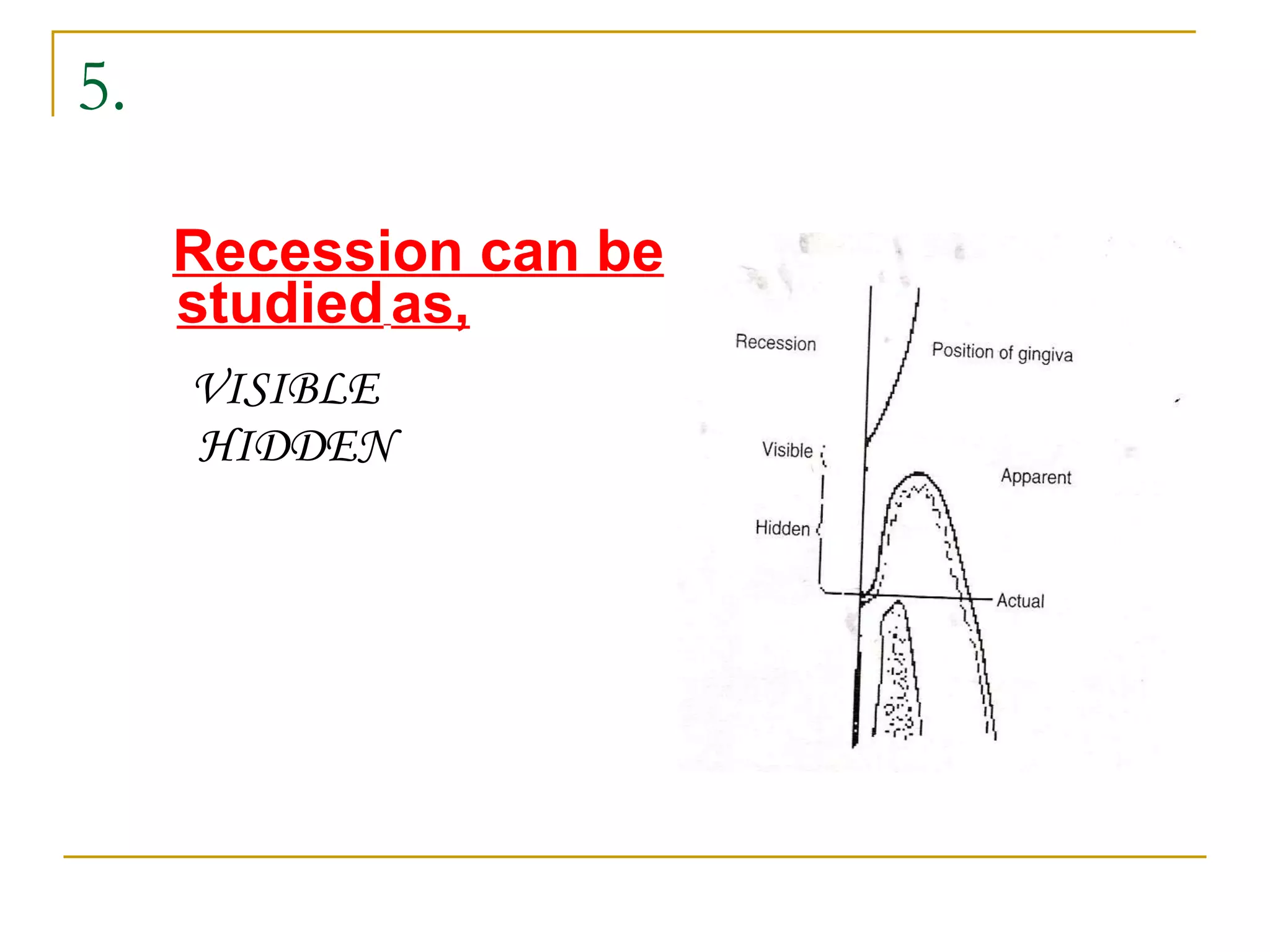 Gingival recession | PPT