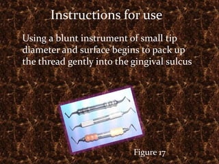 Gingival retraction | PDF