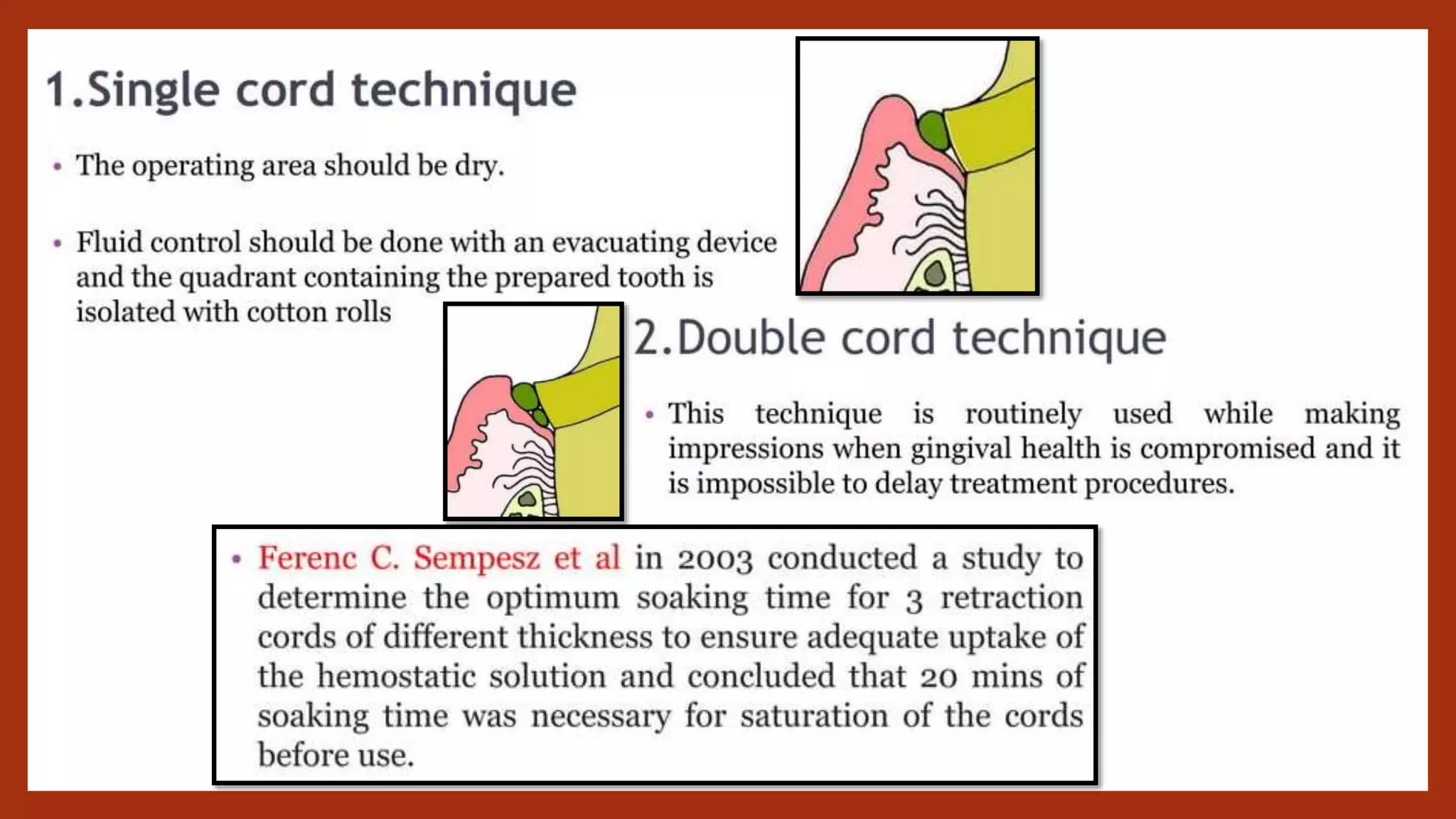 Gingival retraction.pptx