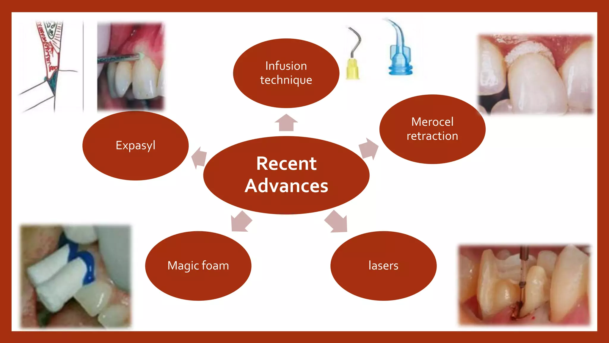 Gingival retraction.pptx