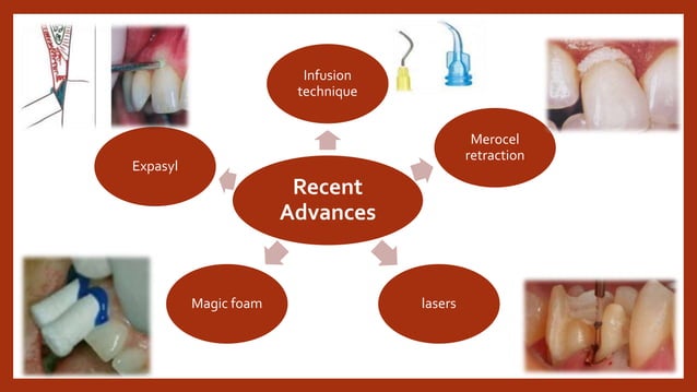Gingival retraction.pptx