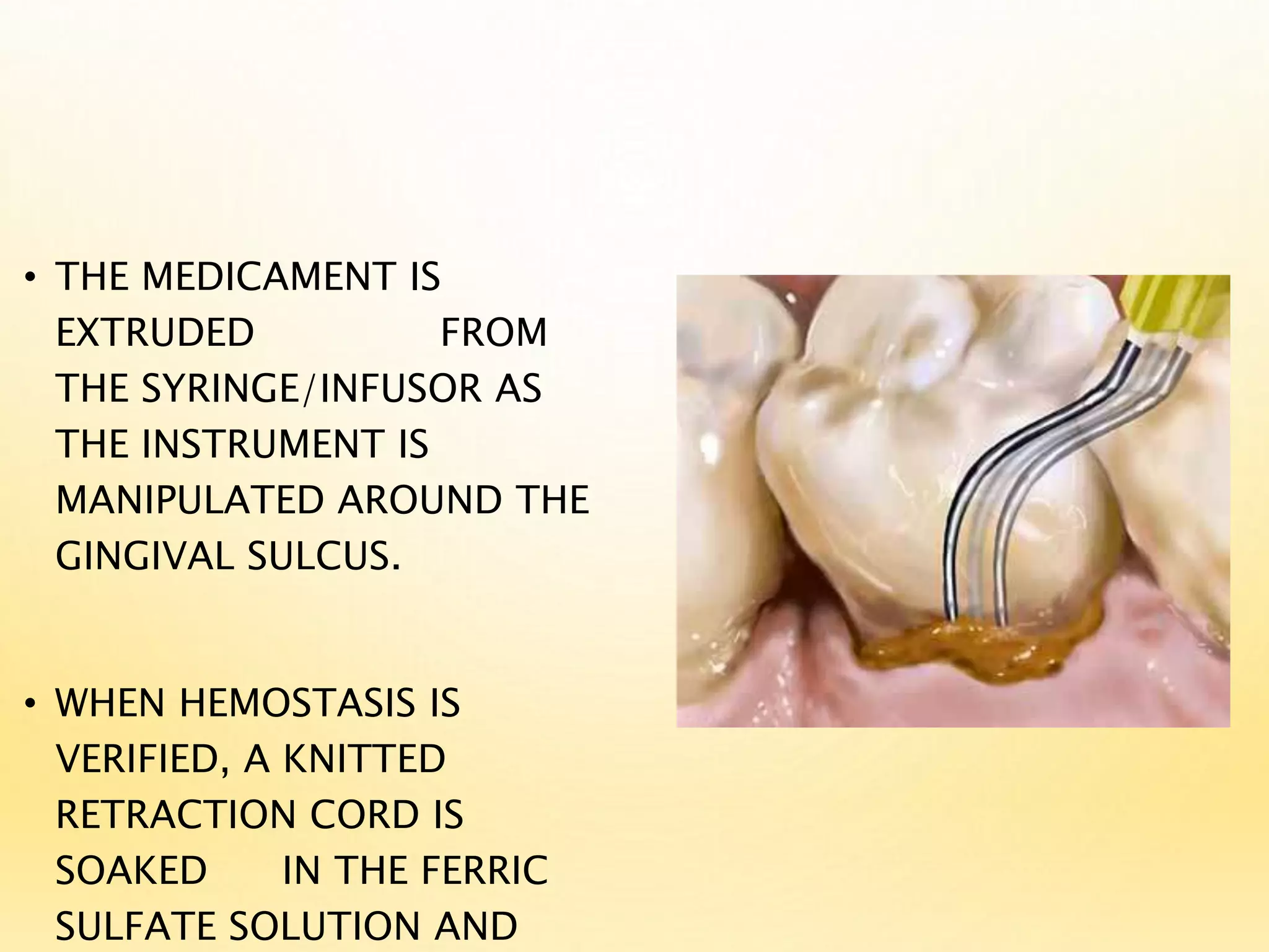 GINGIVAL RETRACTION AND RECENT ADVANCES.ppt