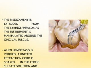 GINGIVAL RETRACTION AND RECENT ADVANCES.ppt