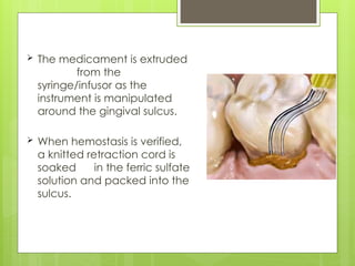 GINGIVAL RETRACTION in removable partial denture prosthodontics | PPTX