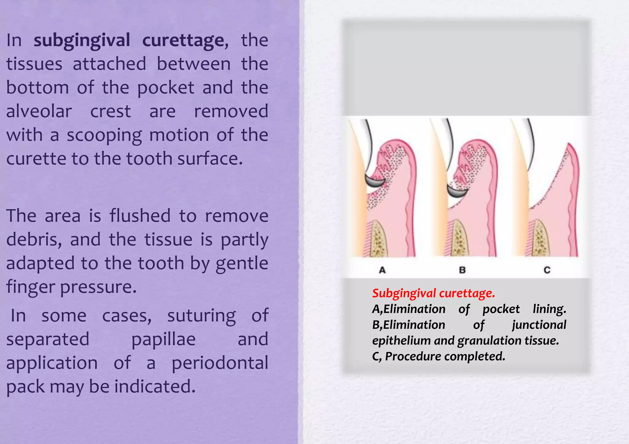 Gingival surgical techniques | PPTX