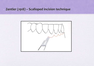 Gingival surgical techniques | PPTX