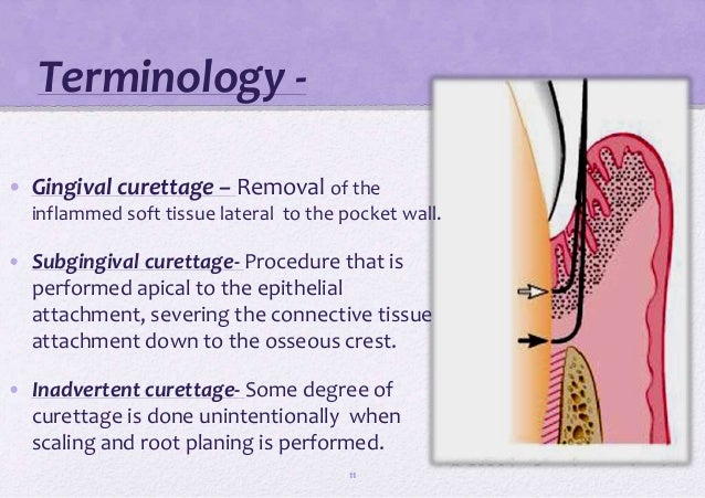 Gingival surgical techniques