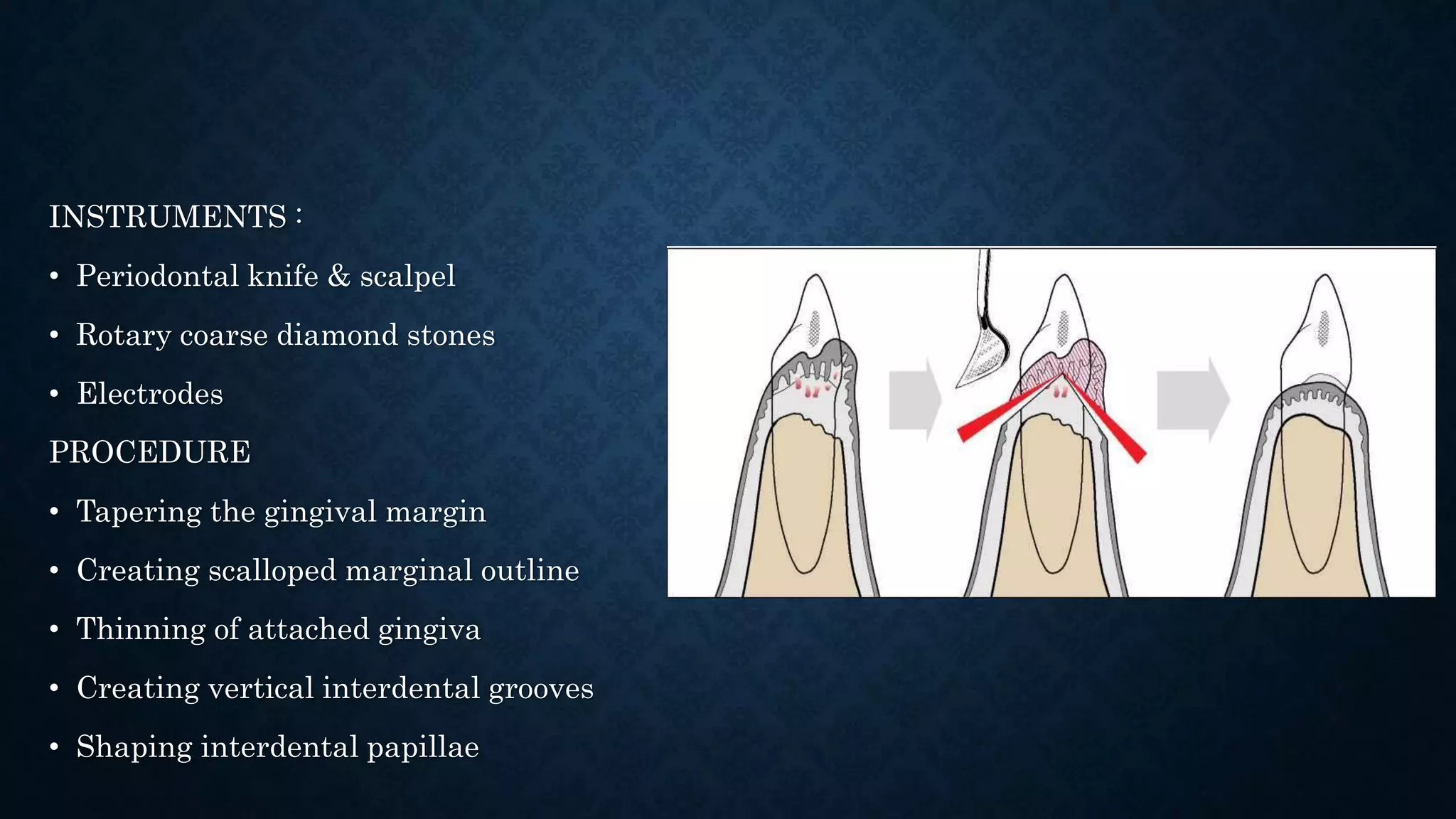 Gingival surgical procedures | PPTX