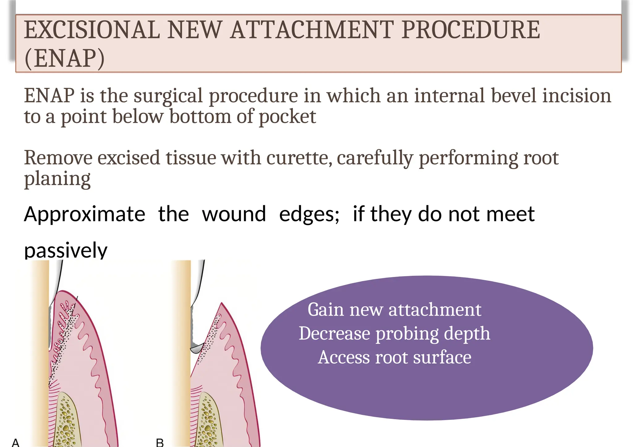 Gingival surgical techniques-Dr Deepthi.pptx