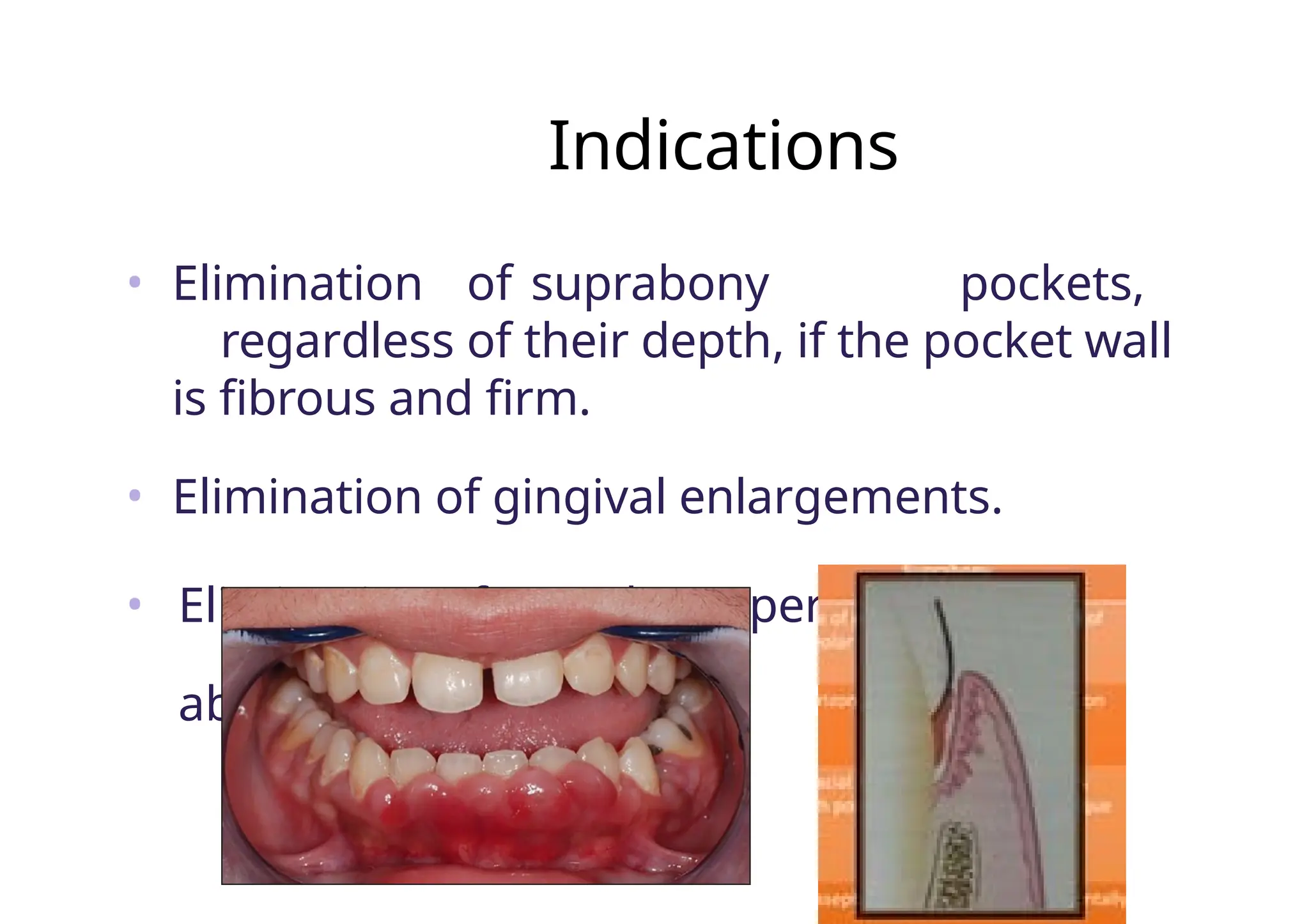 Gingival surgical techniques-Dr Deepthi.pptx