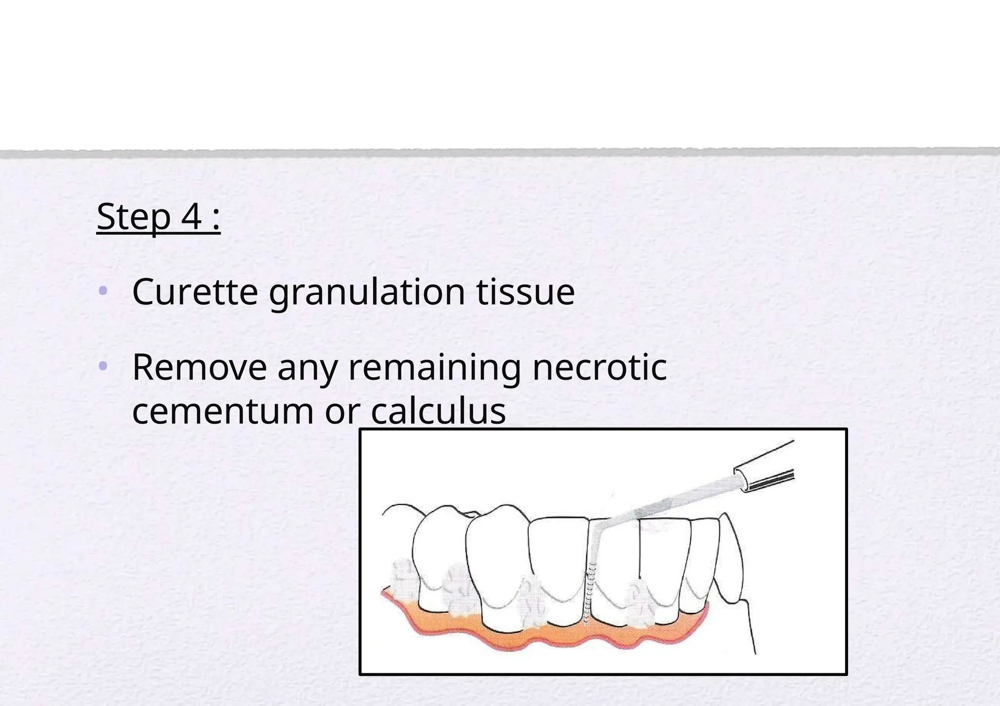 Gingival surgical techniques-Dr Deepthi.pptx