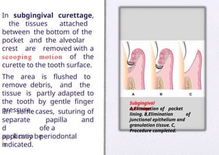 Gingival surgical techniques-Dr Deepthi.pptx