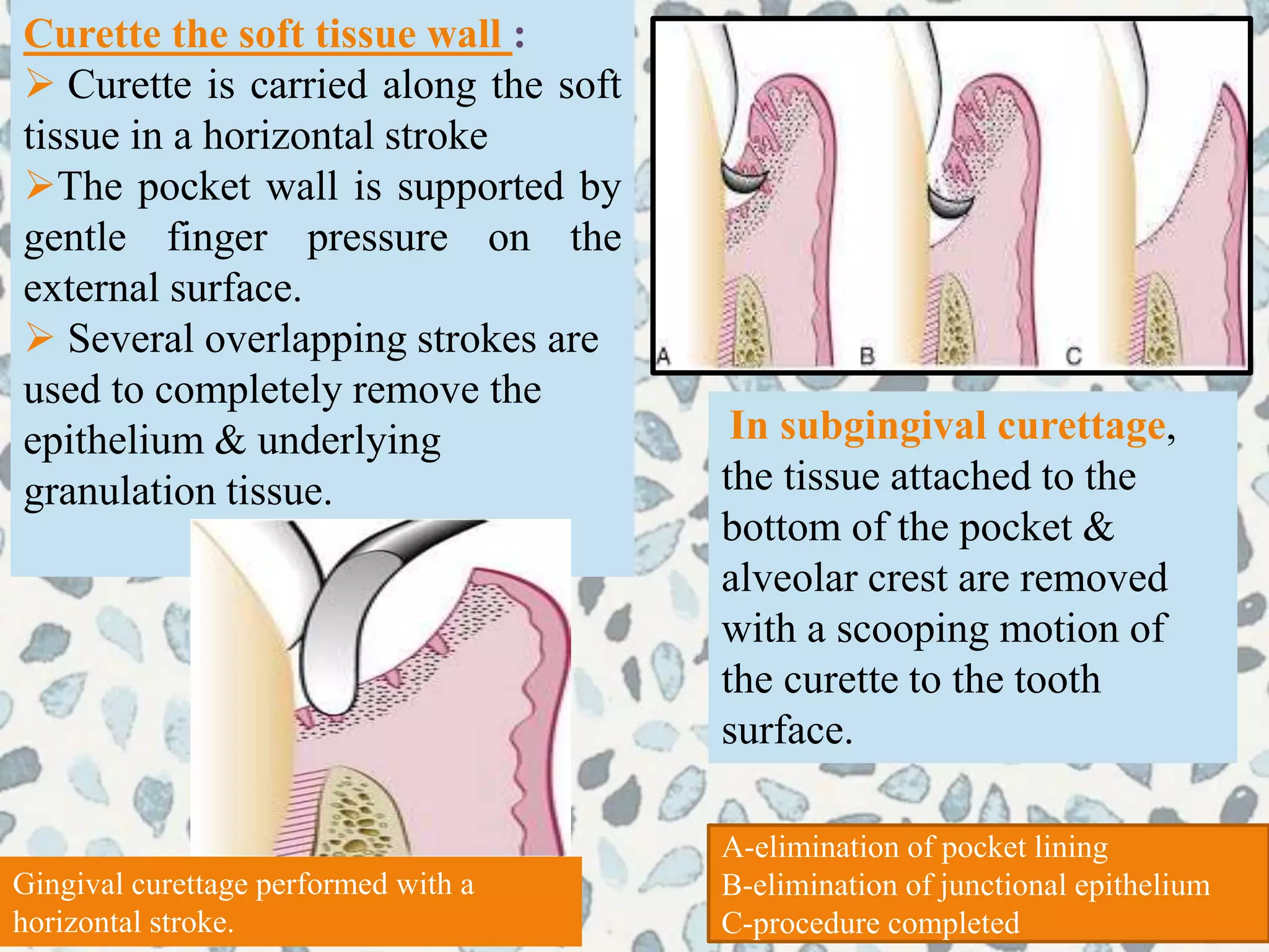 GINGIVAL SURGICAL TECHNIQUES IN PERIODONTOLOGY | PPTX