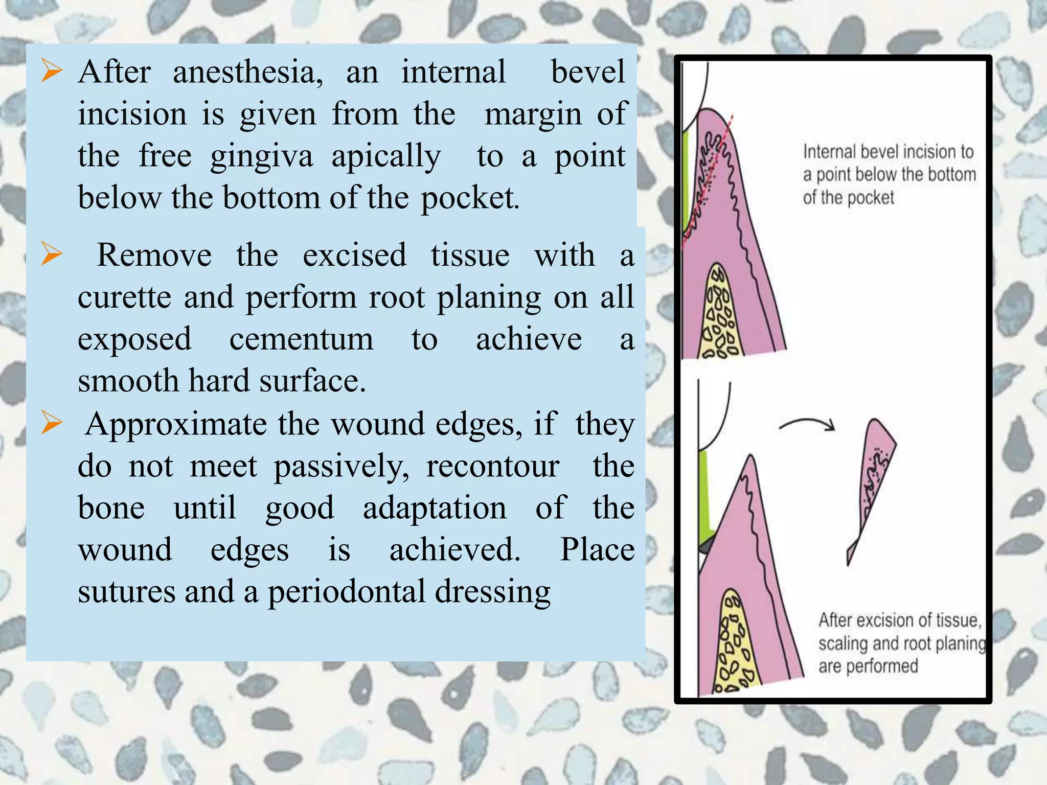 GINGIVAL SURGICAL TECHNIQUES IN PERIODONTOLOGY | PPTX