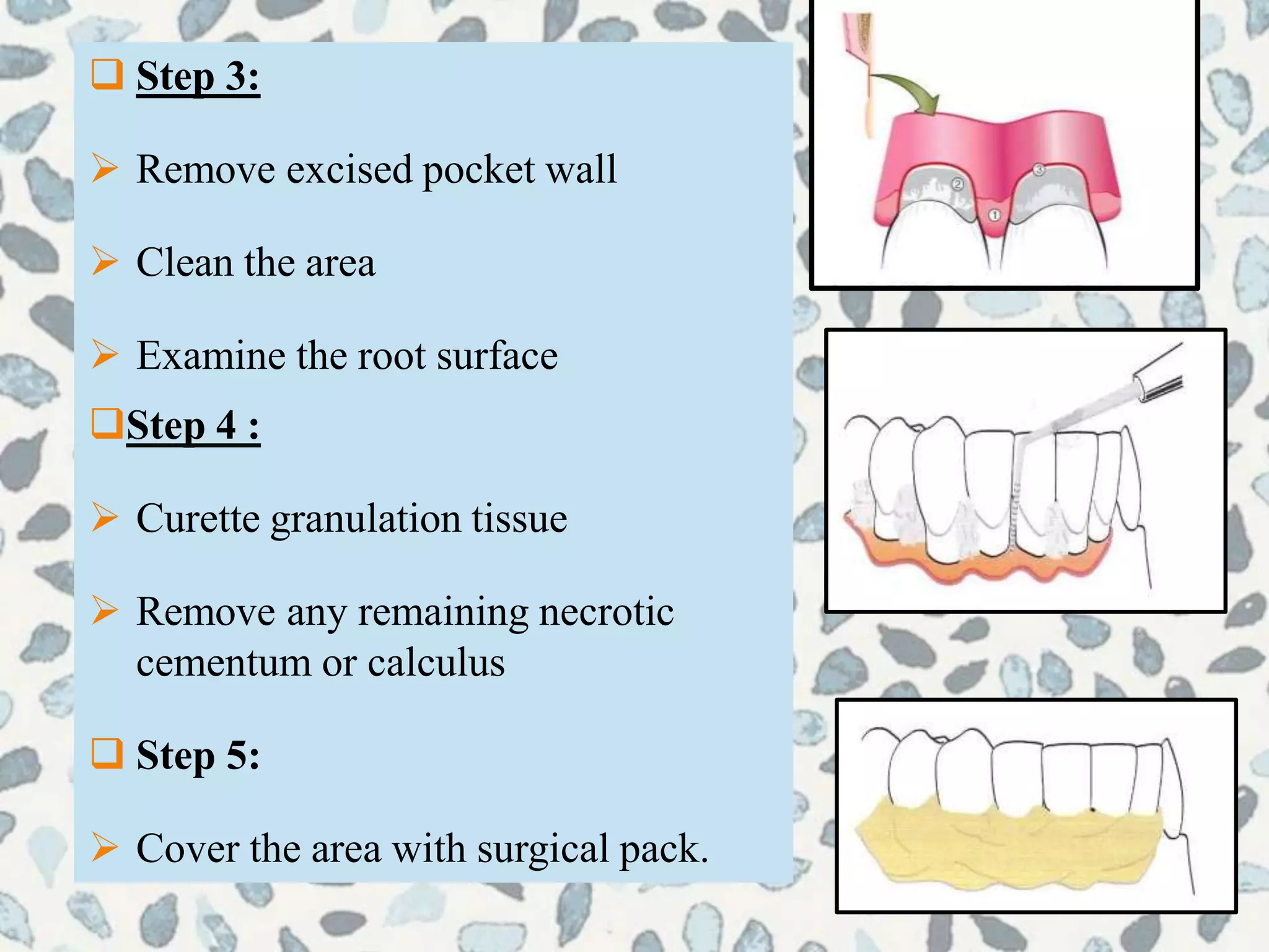 GINGIVAL SURGICAL TECHNIQUES IN PERIODONTOLOGY | PPTX