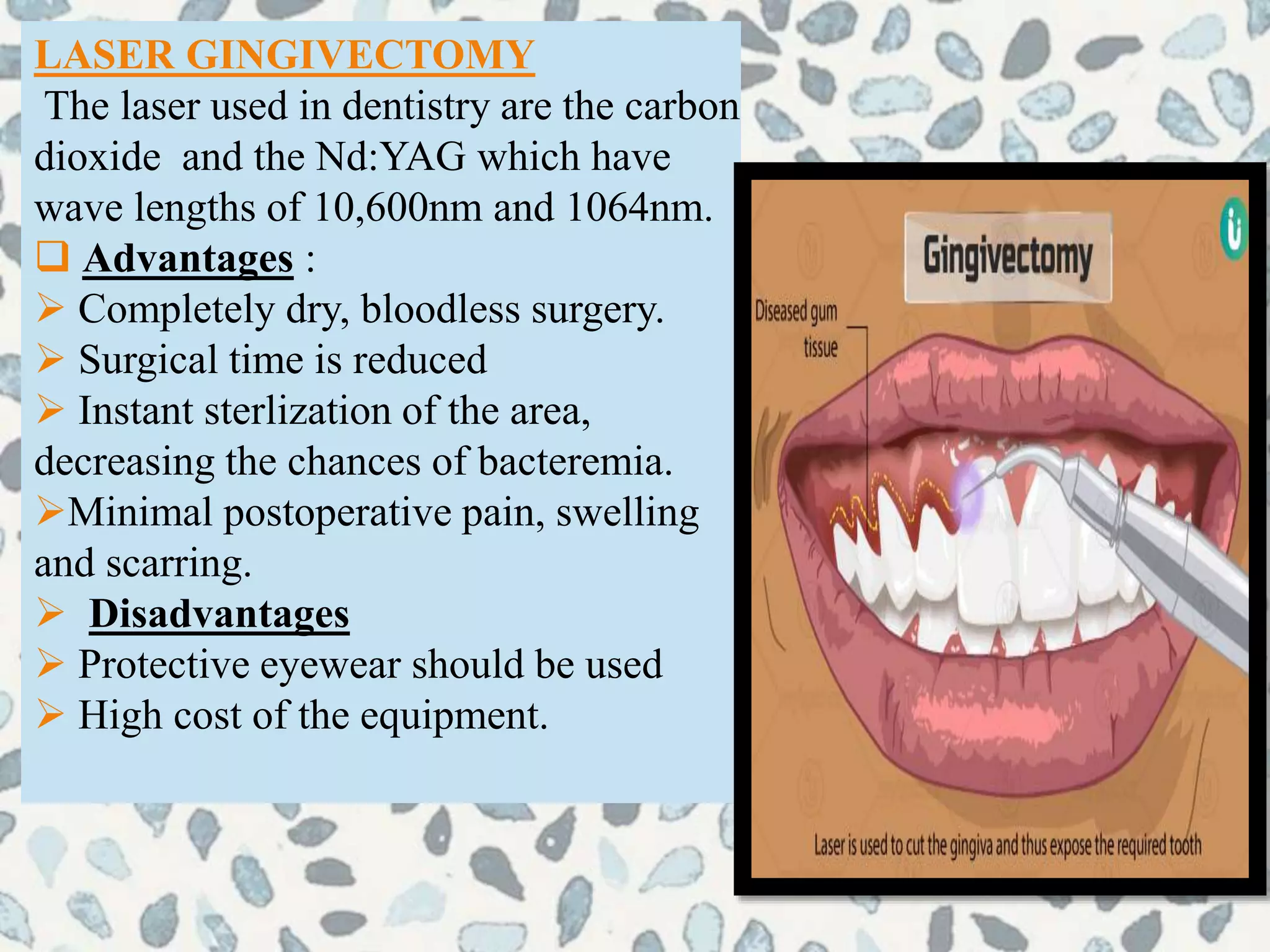 GINGIVAL SURGICAL TECHNIQUES IN PERIODONTOLOGY | PPTX