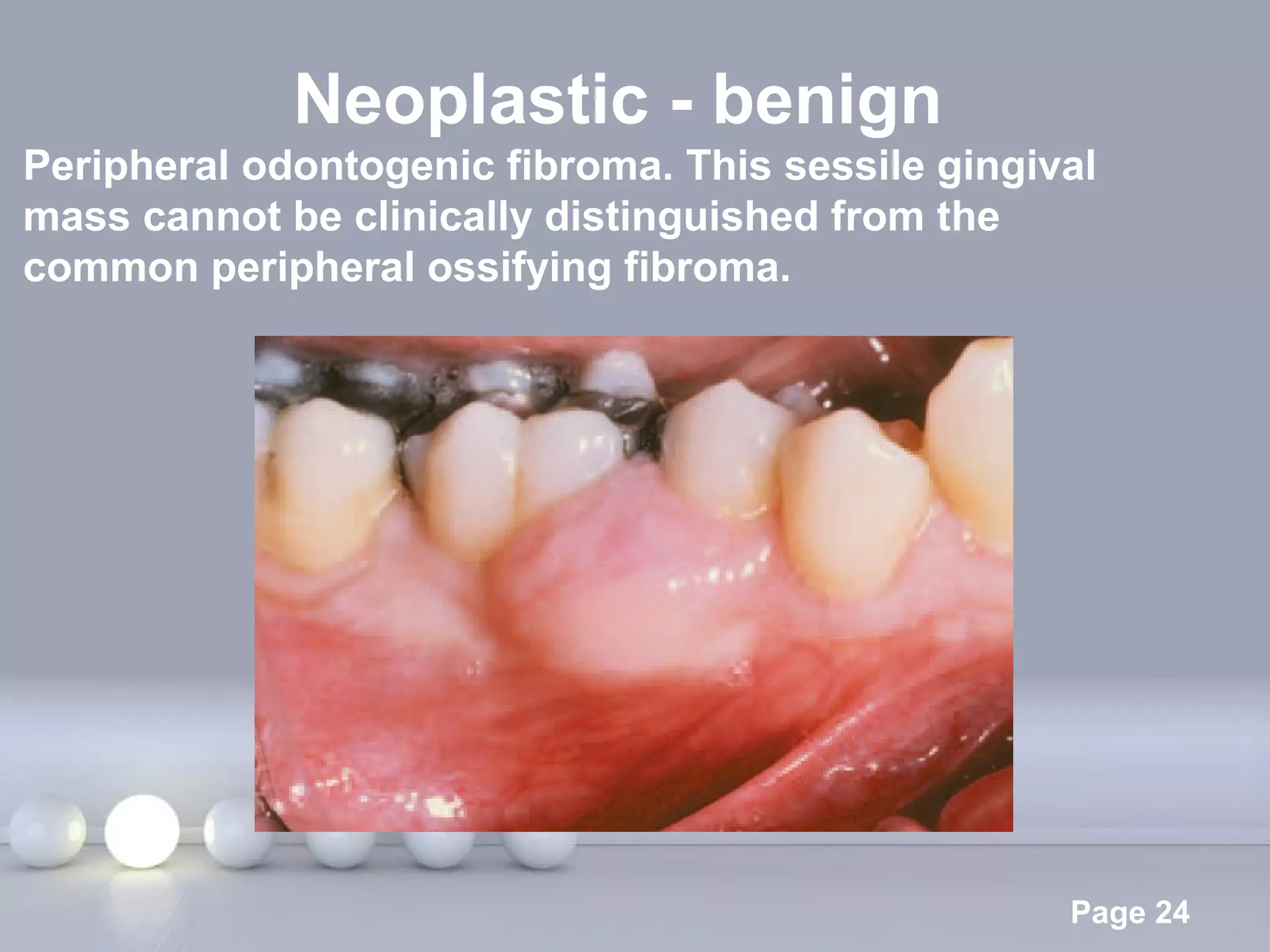 Gingival swellings differential diagnosis | PPT