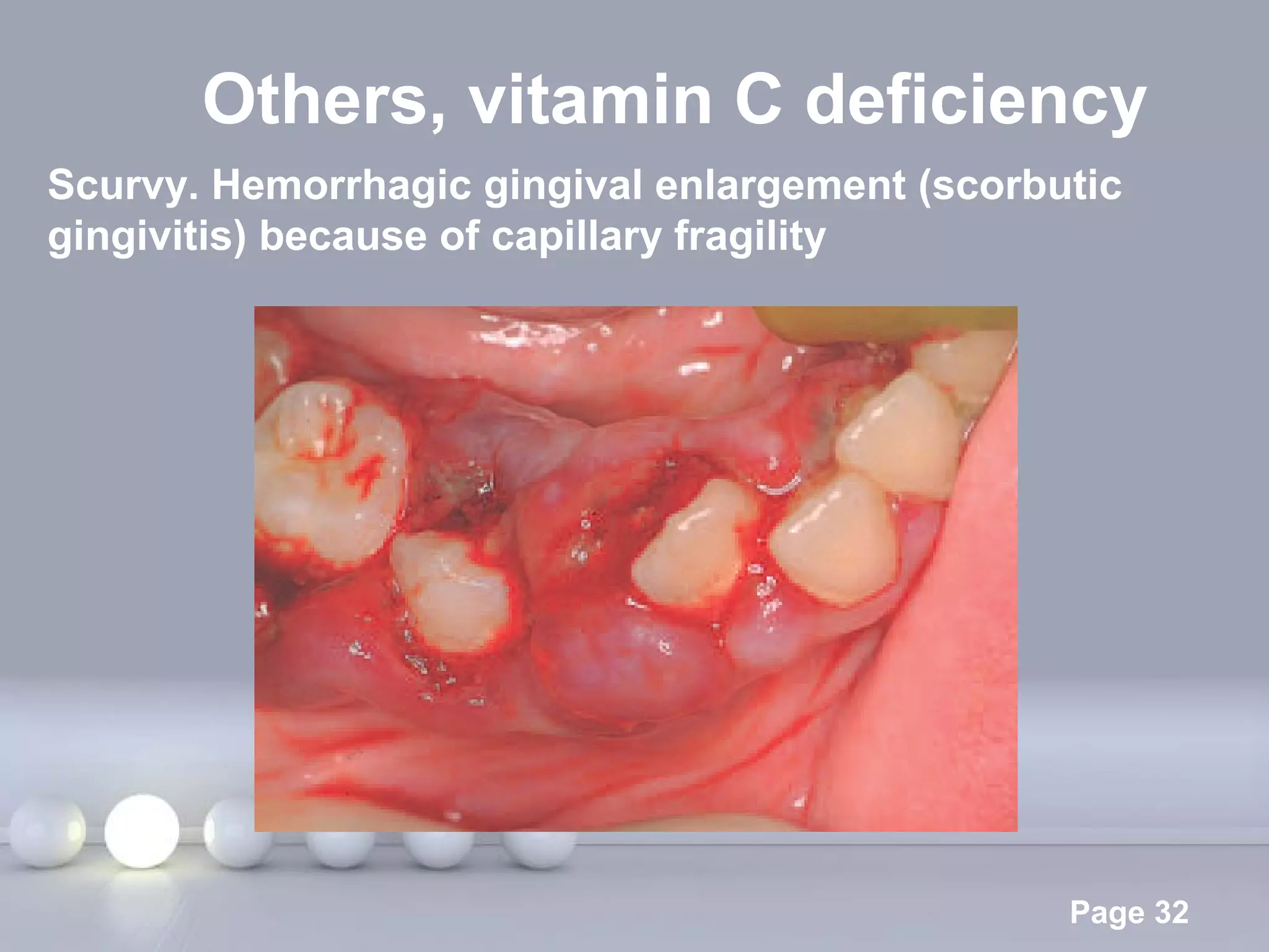 Gingival swellings differential diagnosis | PPT