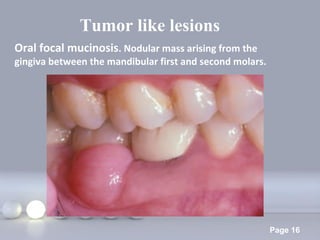 Gingival swellings differential diagnosis | PPT