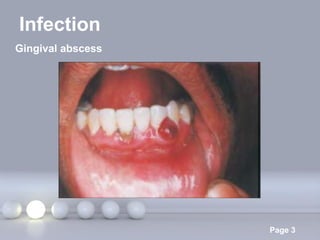 Gingival swellings differential diagnosis | PPT