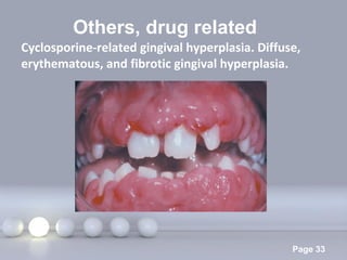 Gingival swellings differential diagnosis | PPT