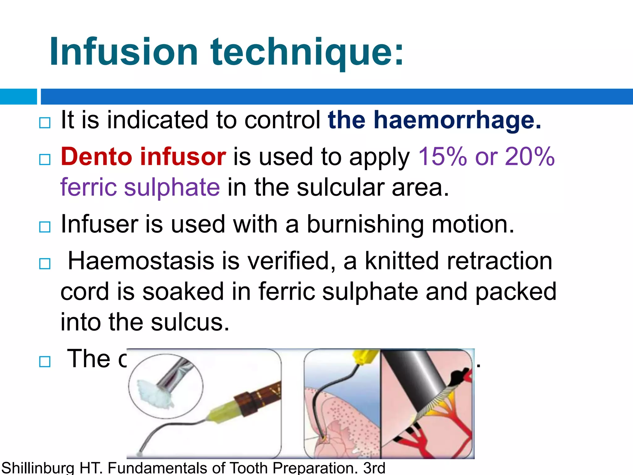 Gingival tissue displacement in fpd | PPTX