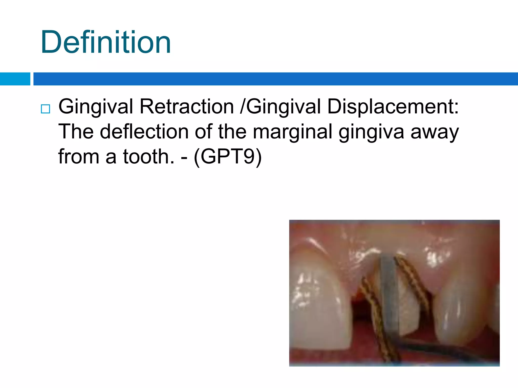 Gingival tissue displacement in fpd | PPTX
