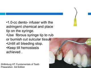 Gingival tissue displacement in fpd | PPTX