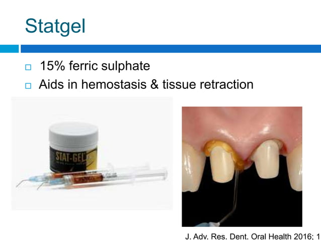 Gingival tissue displacement in fpd | PPTX