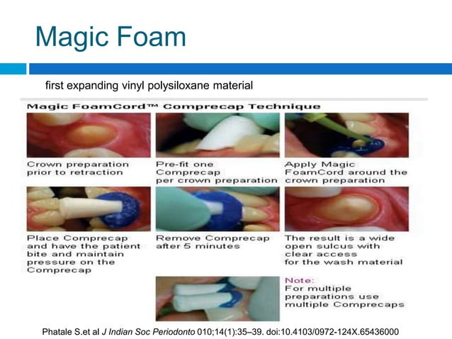 Gingival tissue displacement in fpd | PPTX