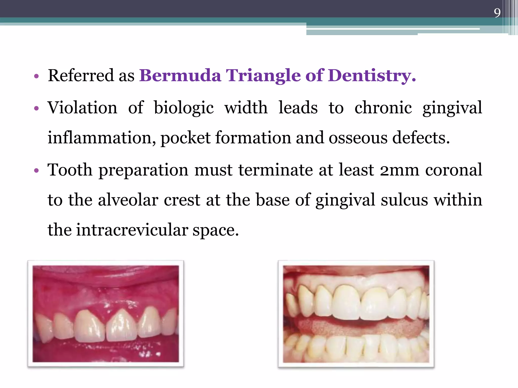 Gingival tissue management | PPTX