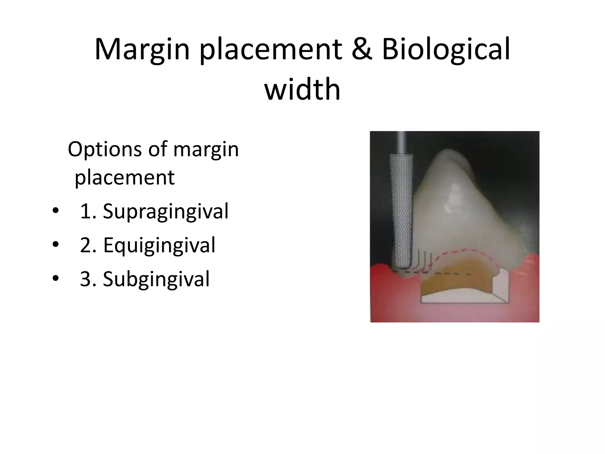 Gingival tissue management | PPTX