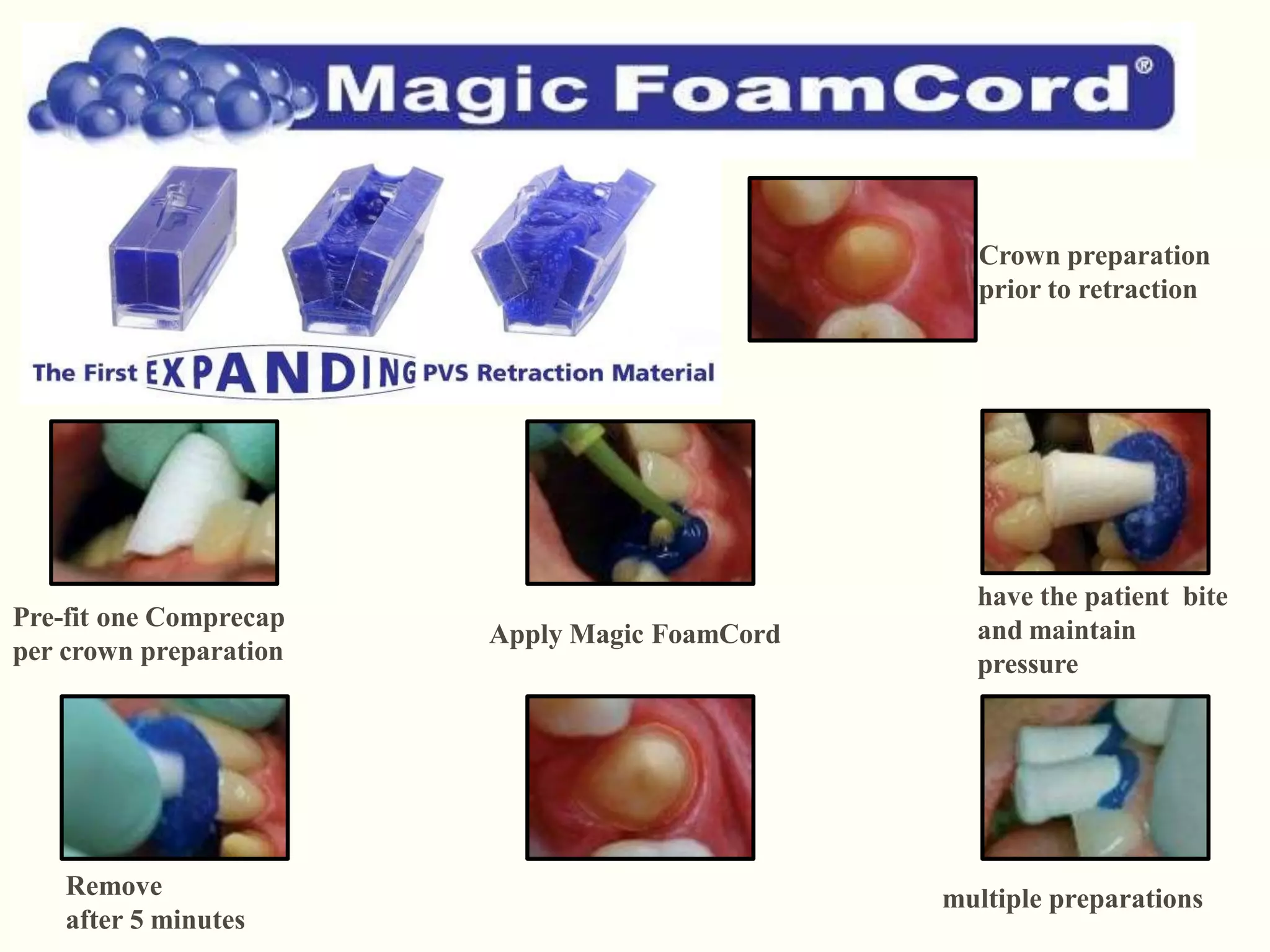 GINGIVAL TISSUE RETRACTION.pptx