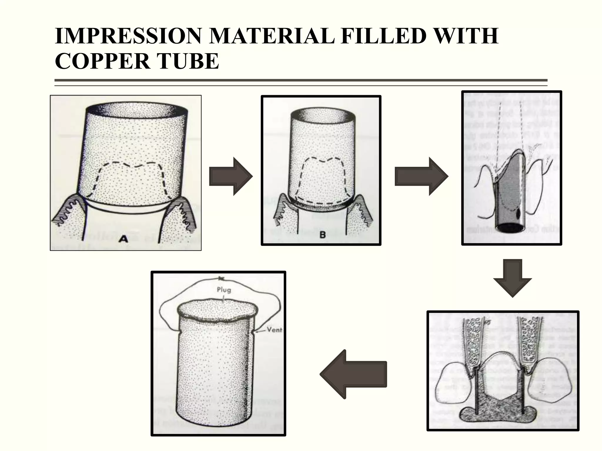GINGIVAL TISSUE RETRACTION.pptx