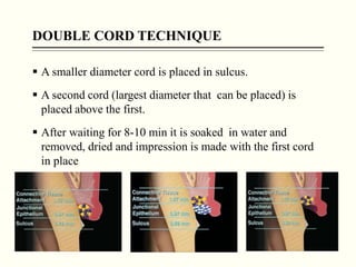 GINGIVAL TISSUE RETRACTION.pptx