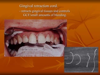 Gingival Tissues management.ppt