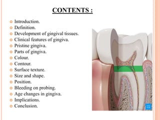 Gingiva (Macroscopic features) | PPTX